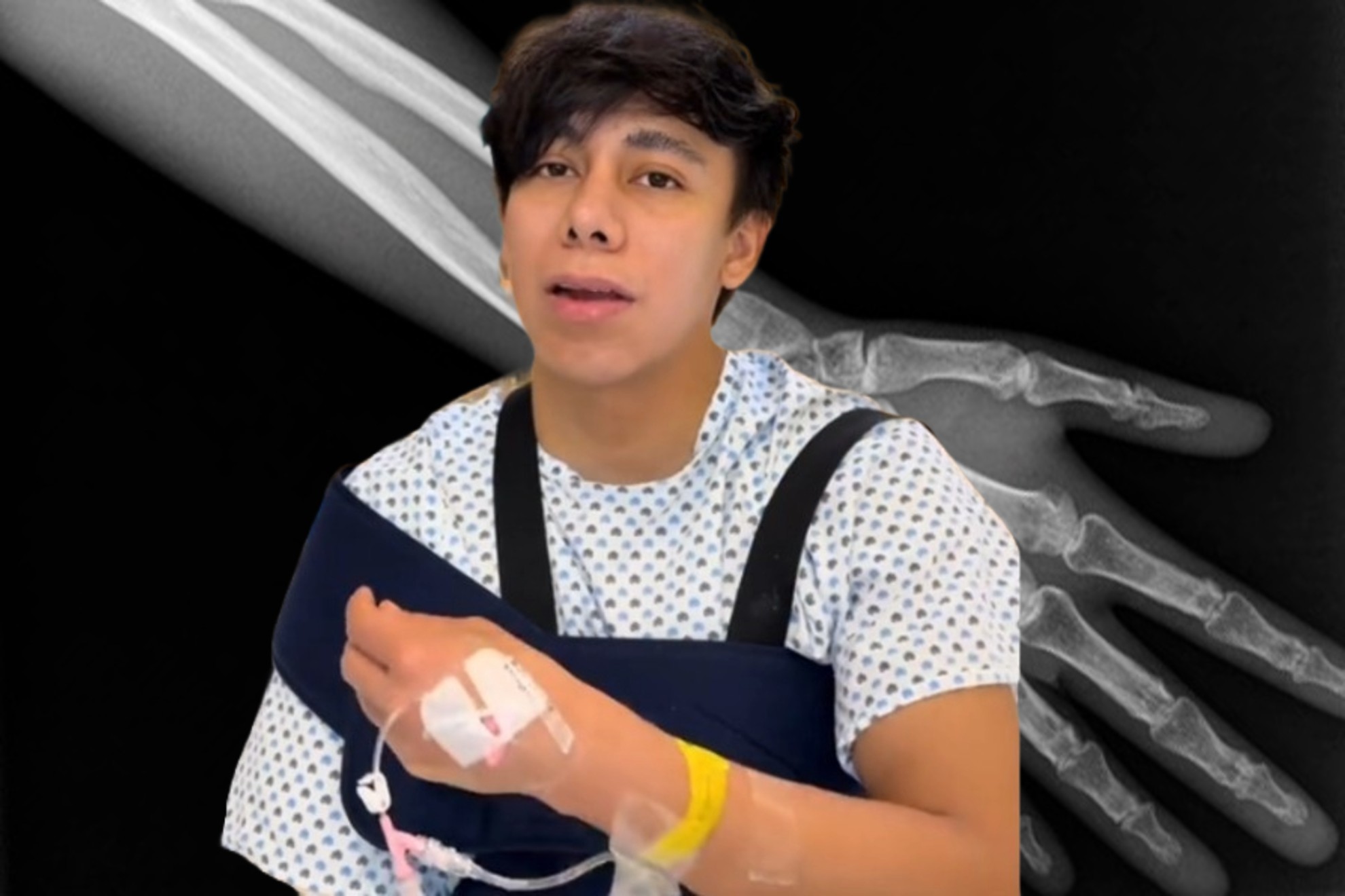 Sonrixs revela cómo fue su accidente: Podría perder la movilidad de su ...