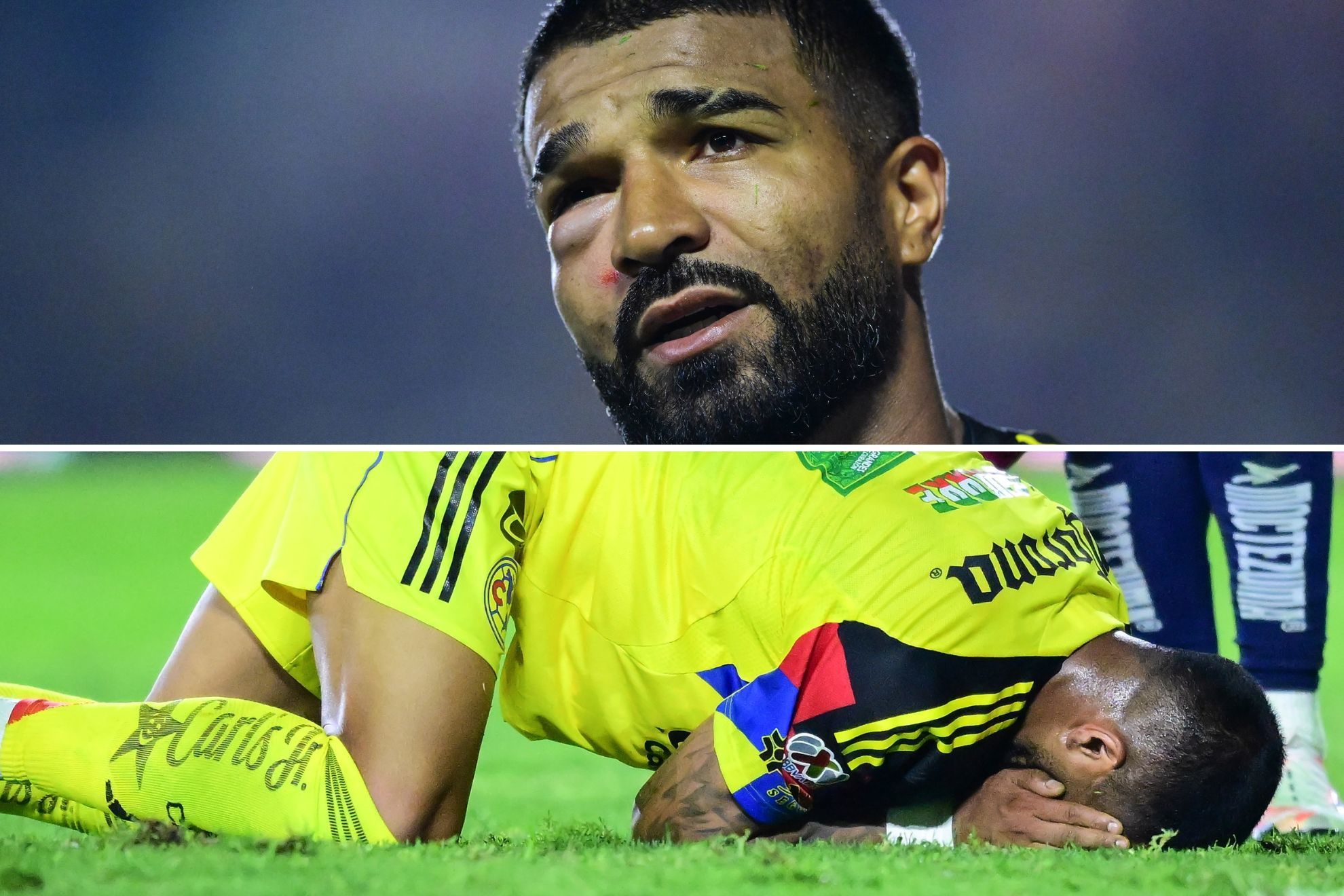 Liga MX 2025: El impresionante golpe que recibió Rodrigo Aguirre en el San Luis vs América, así ...