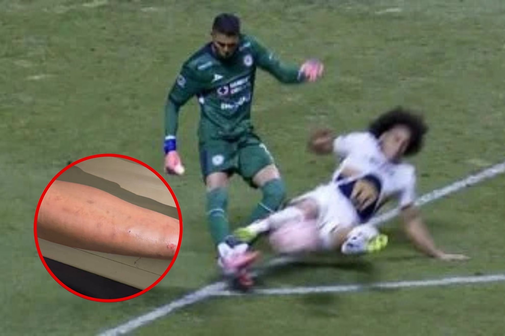 Liga MX 2025: Terrible imagen de la pierna de Kevin Mier; todo Cruz ...